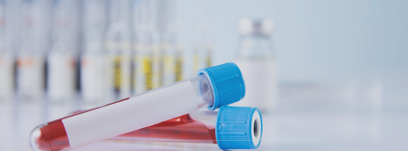 Testosterone Replacement Therapy | Free Appointment – Synergistic Labs